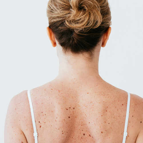 Dermatology And Laser Aesthetic Skin Services | Skin MD